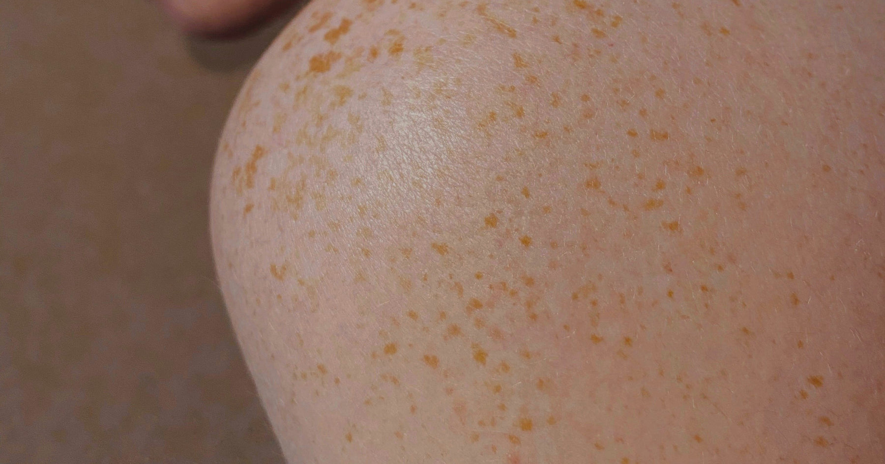 The Structure & Function of Skin - BEAUTOLOGY LAB