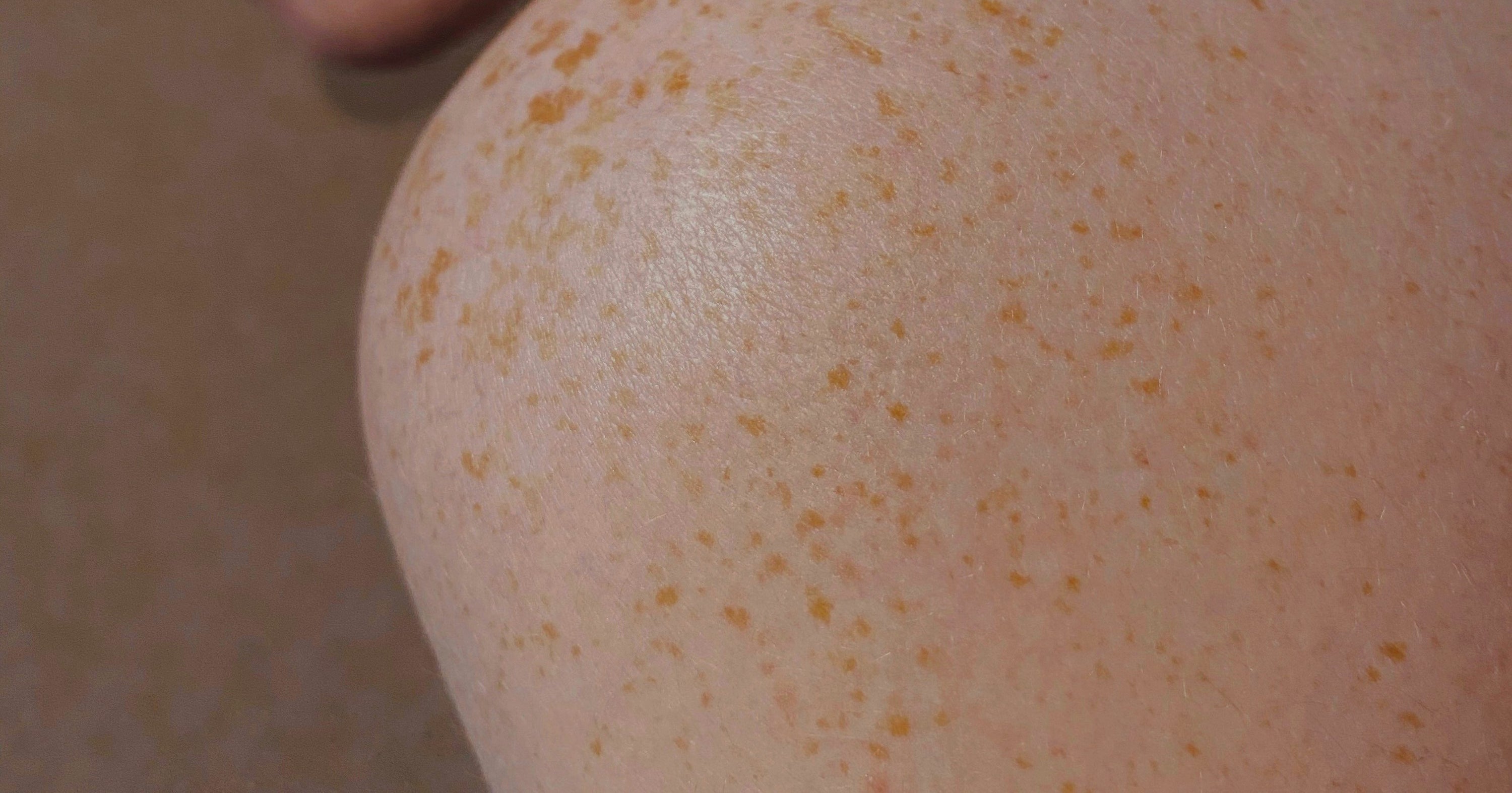 The Structure & Function of Skin - BEAUTOLOGY LAB